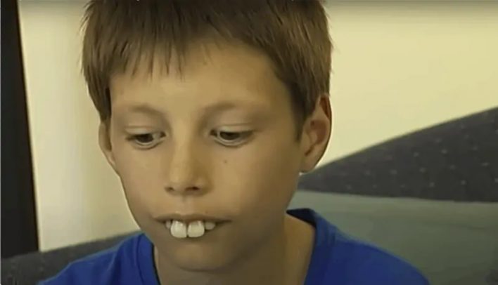 Bucktoothed “Rabbit” Boy Unbelievably Transforms. Find Out How He Looks ...